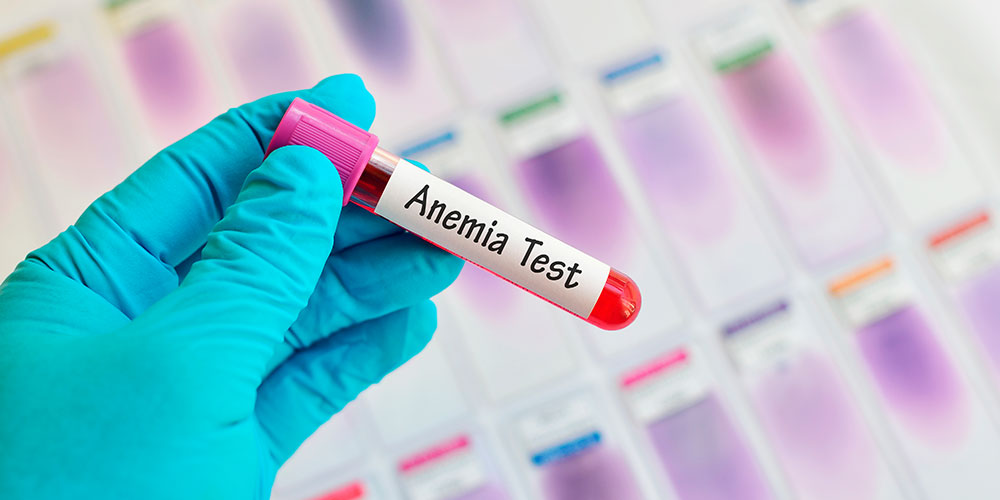 Conectando Pacientes | Anemia y cáncer, ¿cómo se relacionan?